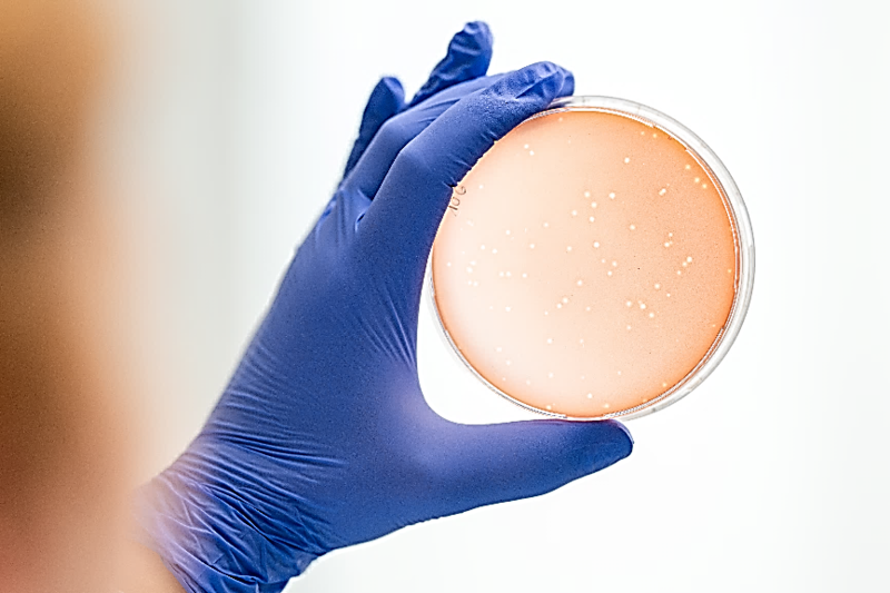 Antiviral surface functionalizations | TITK